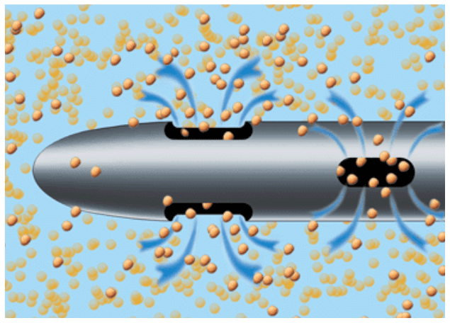 Vaserlipo | Ultrasound-assisted Liposuction